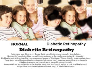 Common eye disorders that most people face | PDF