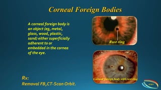 Common eye injury | PPTX