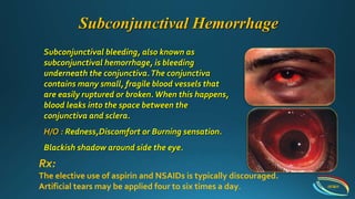 Common eye injury | PPTX