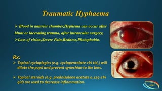Common eye injury | PPTX