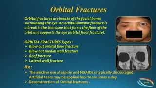 Common eye injury | PPT