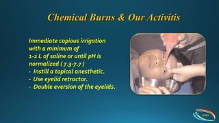 Common eye injury | PPT