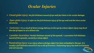Common eye injury | PPTX