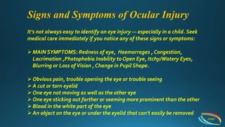 Common eye injury | PPTX