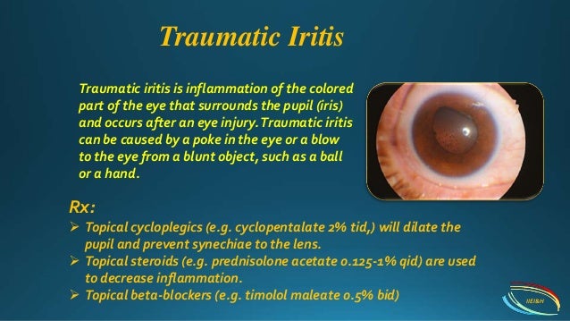 Common eye injury