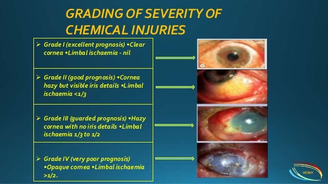 Common eye injury