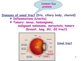 Common Eye Problem | PPT