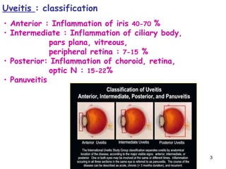 Common Eye Problem | PPT