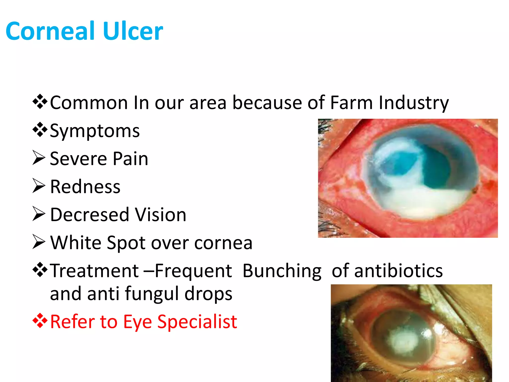 Common eye problem corneal ulcer, glaucoma, cataract, diabetic ...