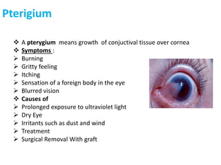 Common eye problem corneal ulcer, glaucoma, cataract, diabetic ...