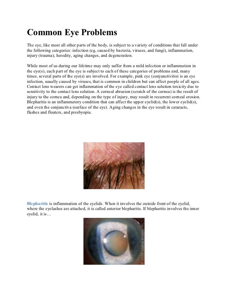 Common eye problems