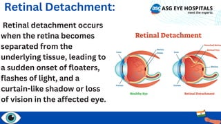 Common Eye Problems | PDF