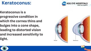 Common Eye Problems | PDF