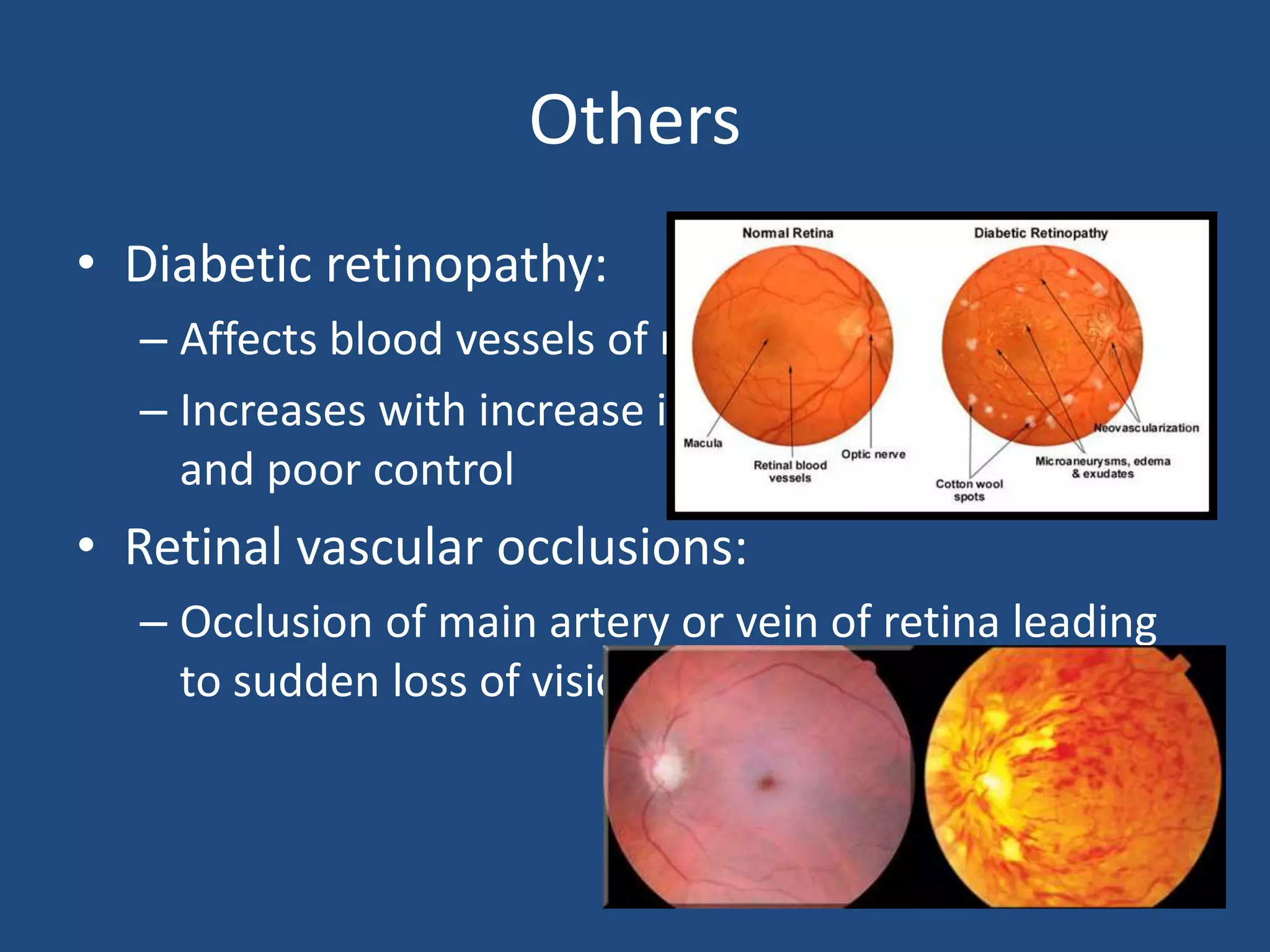 Common eye problems in old age | PPTX