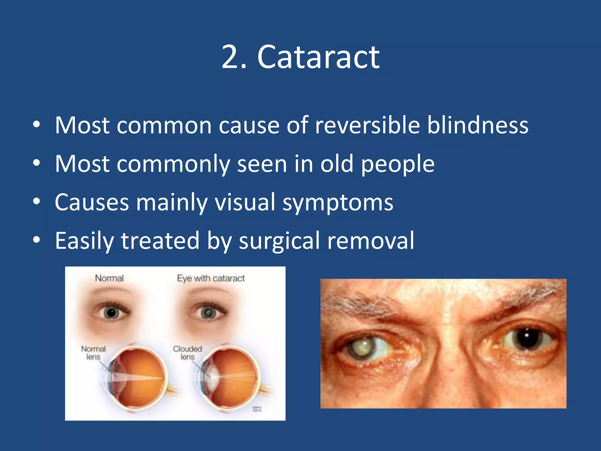 Common eye problems in old age | PPTX