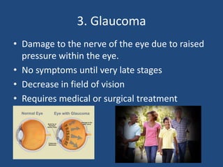 Common eye problems in old age | PPTX