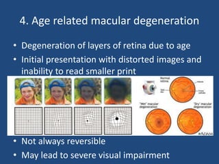 Common eye problems in old age | PPTX