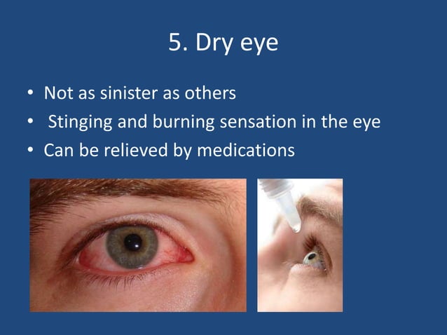 Common eye problems in old age | PPTX