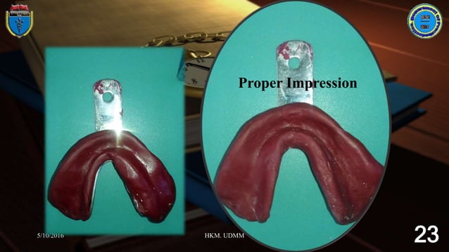 Common Faults in Impression Making 2016 | PPSX | Dental Health ...