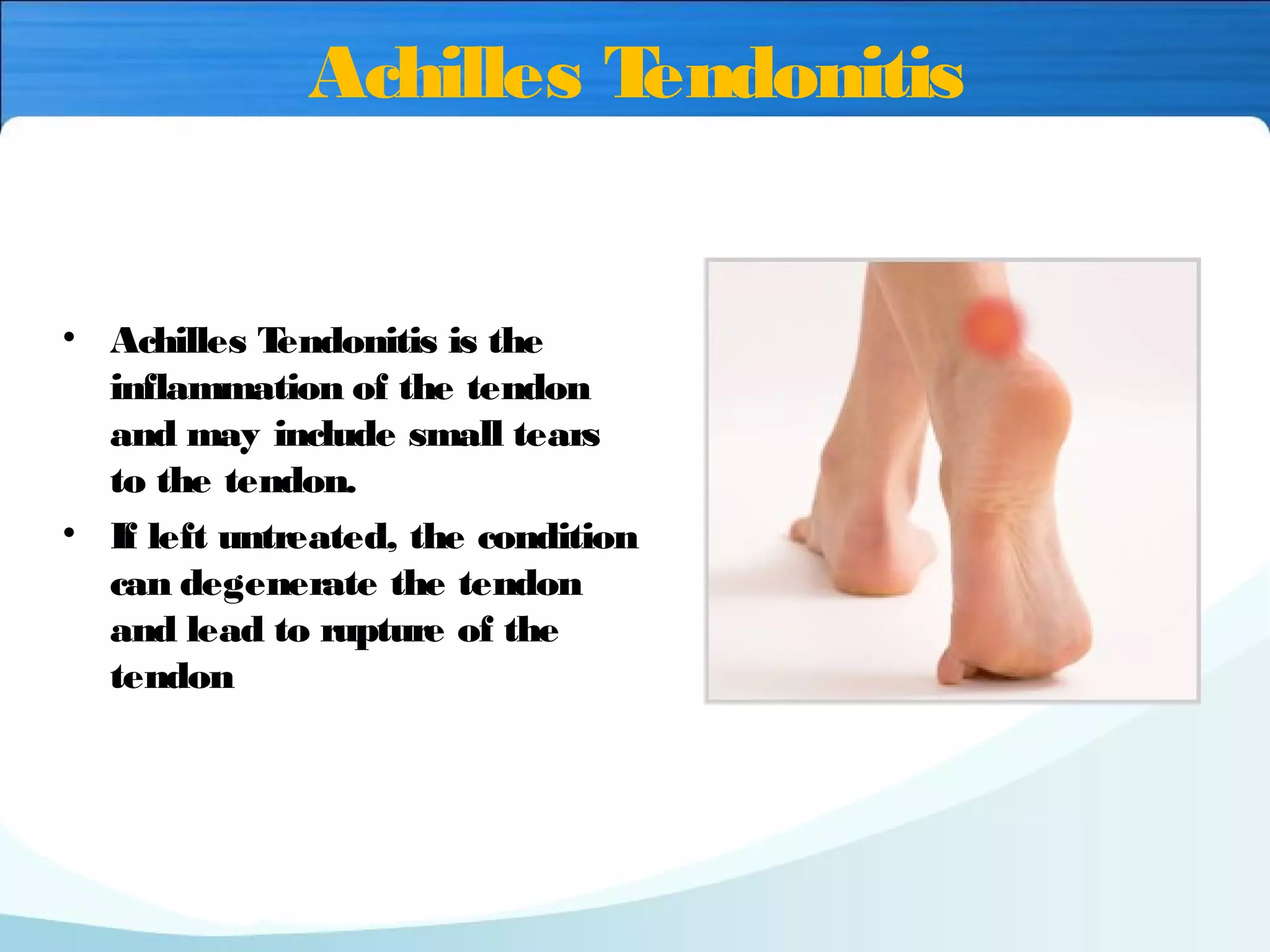Common foot and ankle injuries and diseases | PPT
