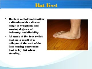 Common foot and ankle injuries and diseases | PPT