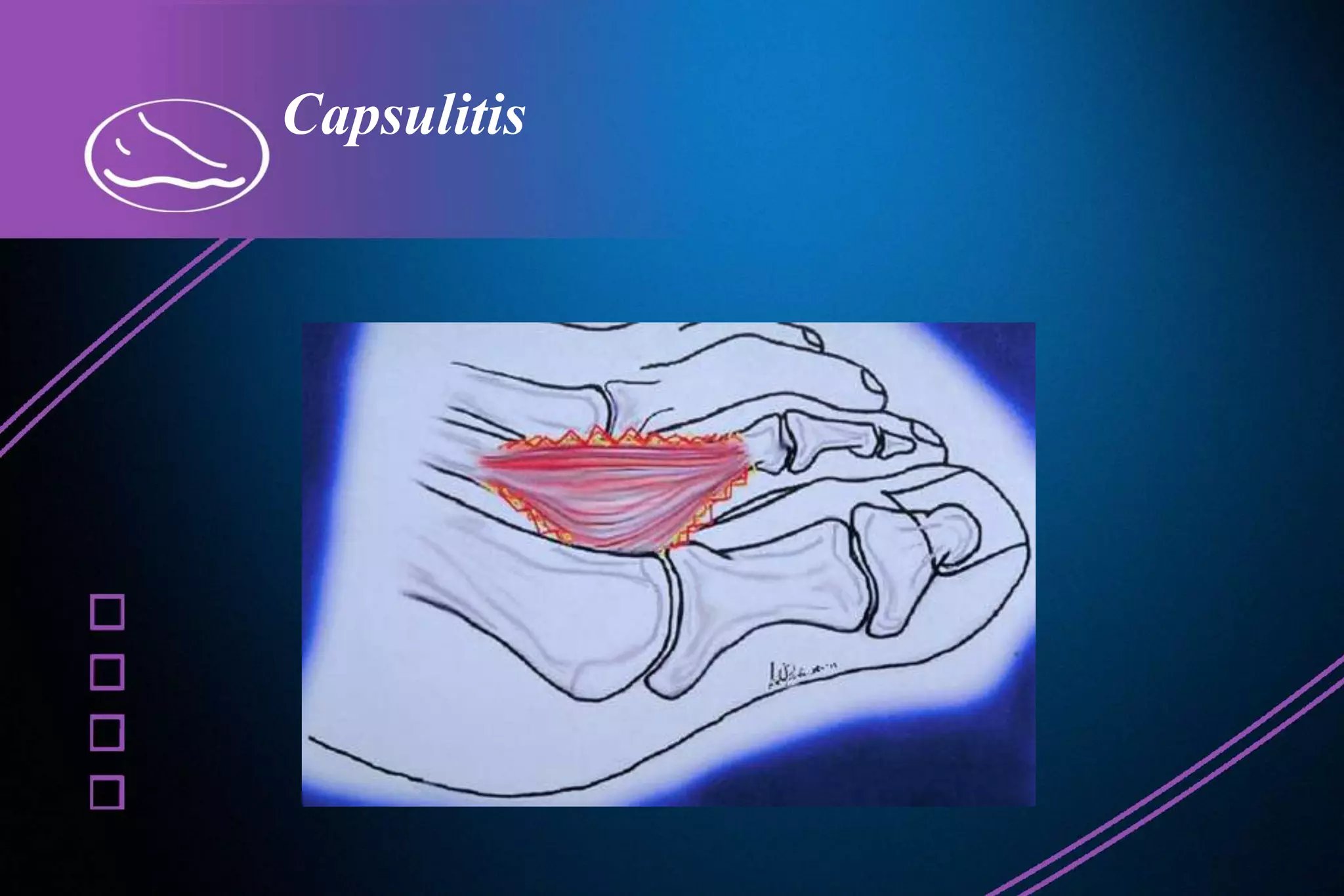 Aspen Foot & Ankle: Common Foot Problems | PPTX | Death, Injury, or ...