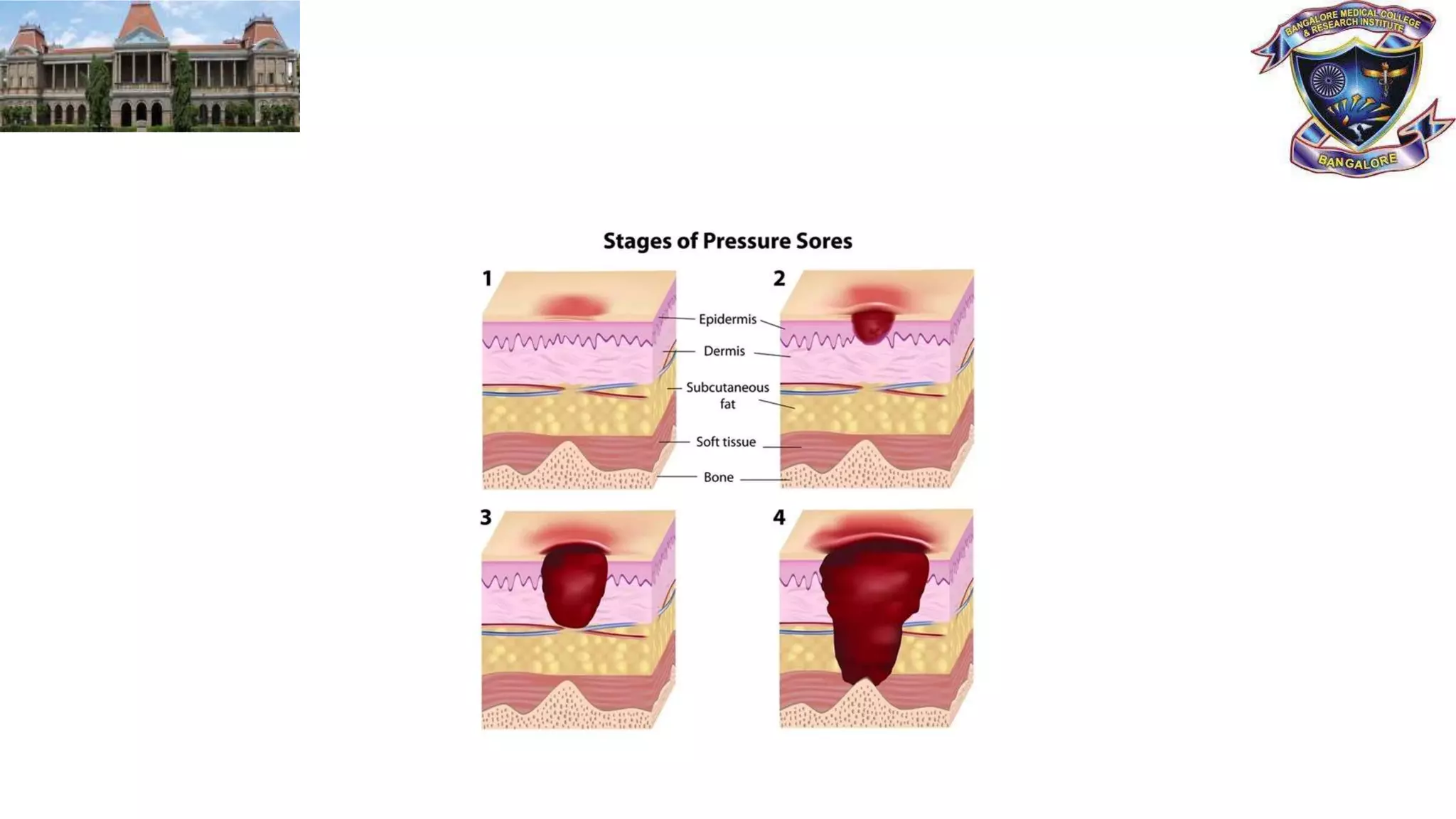 COMMON GERIATRIC SYNDROMES (1).pptx