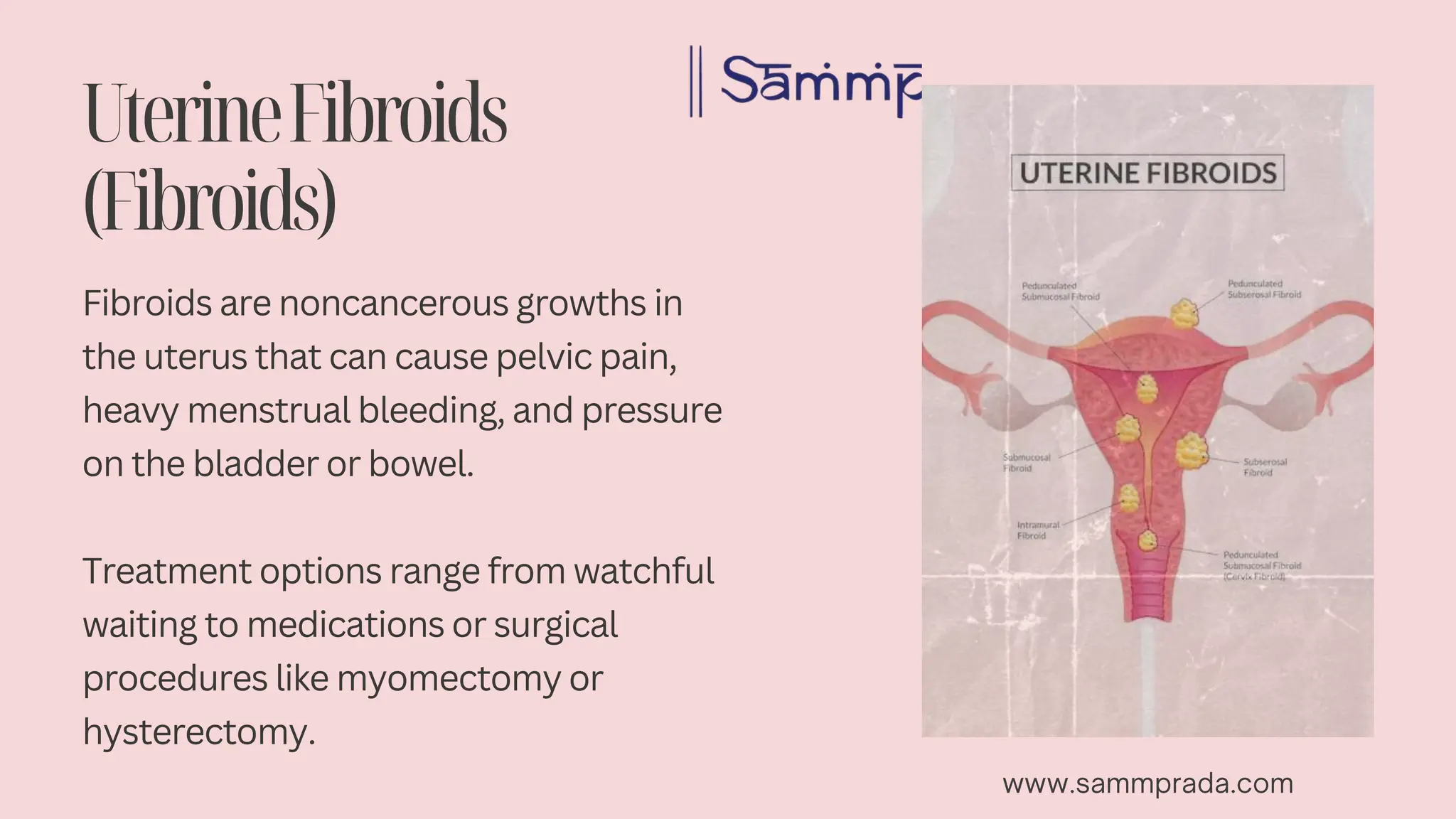 Common Gynecological Conditions Women Suffer!!.pptx