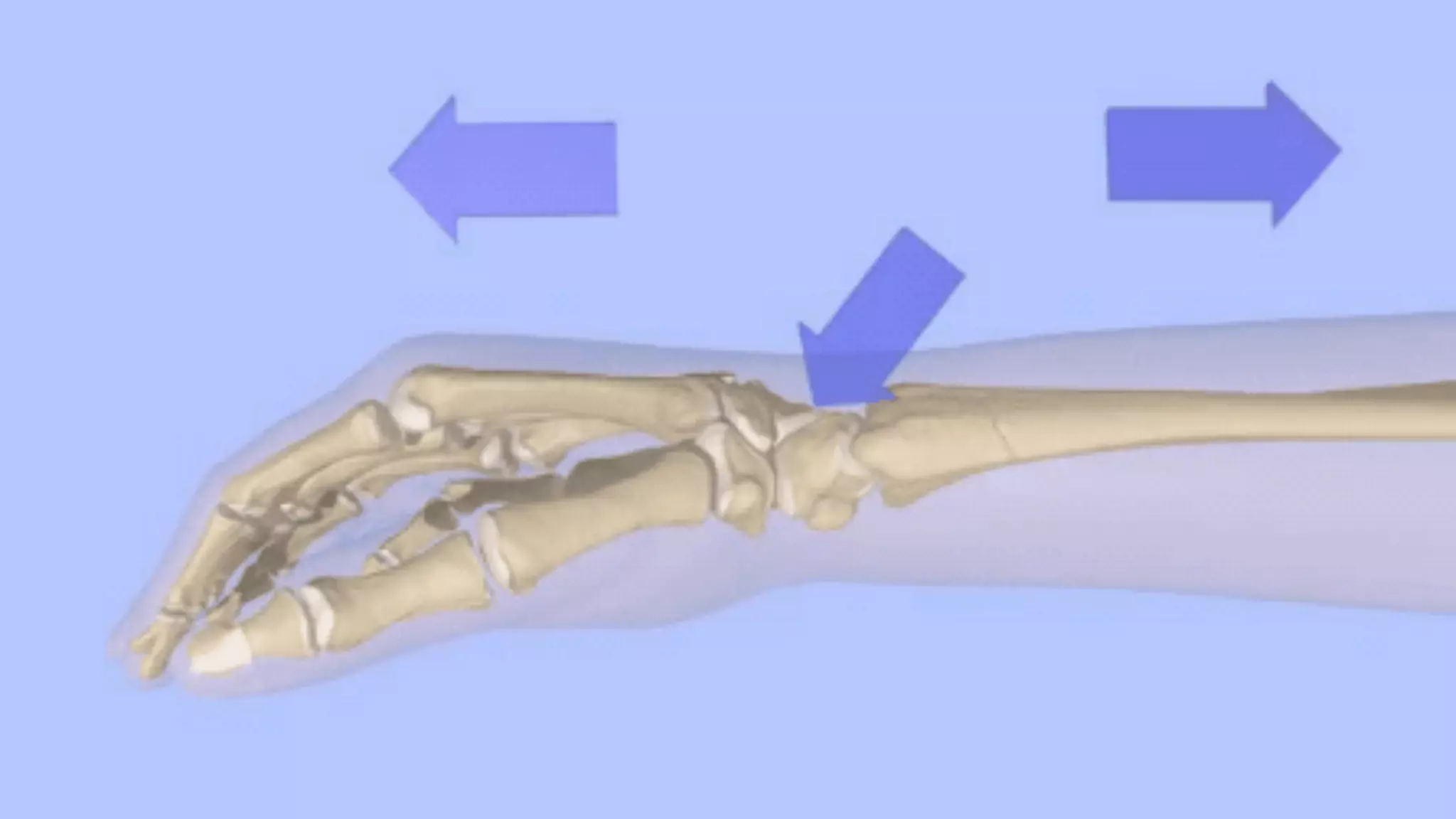Common Hand Fractures & Dislocations | PDF