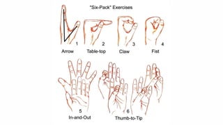 Common Hand Fractures & Dislocations | PDF