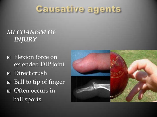 Common hand injuries