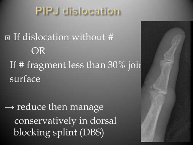 Common hand injuries