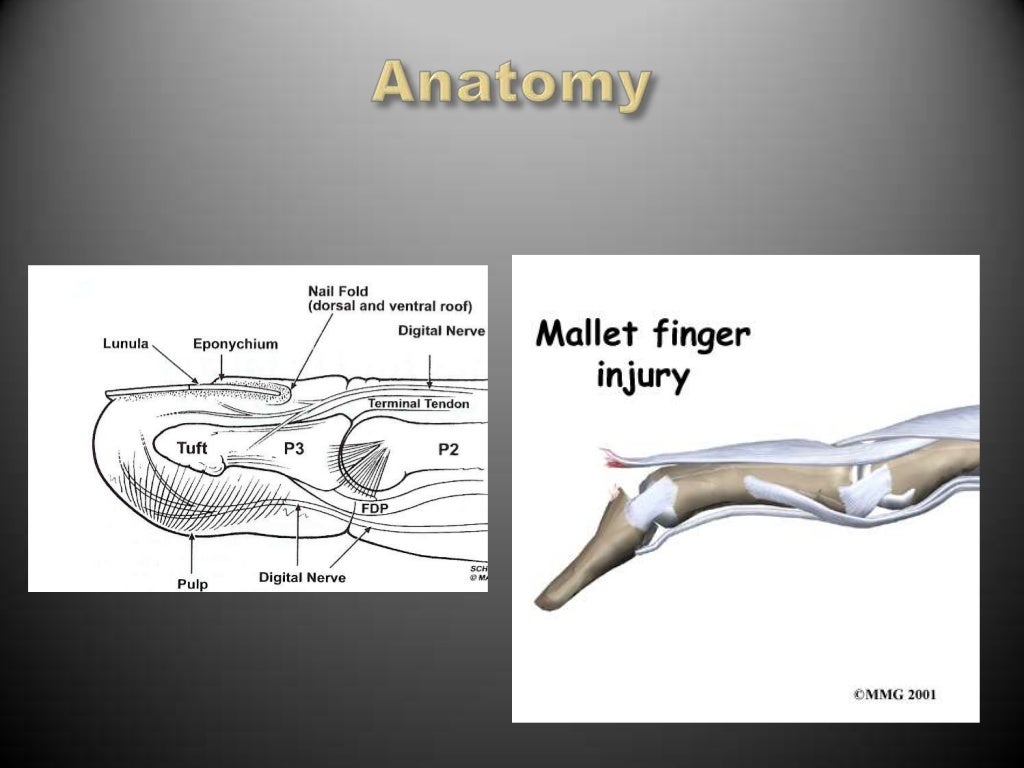 Common hand injuries