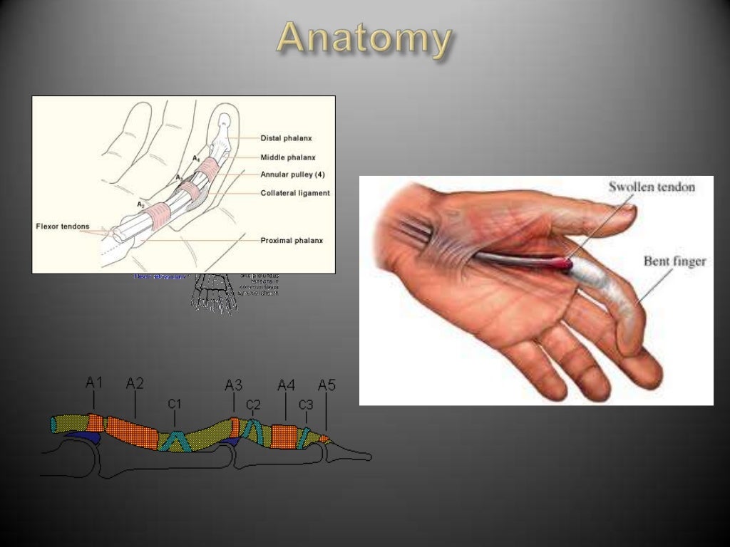 Common hand injuries