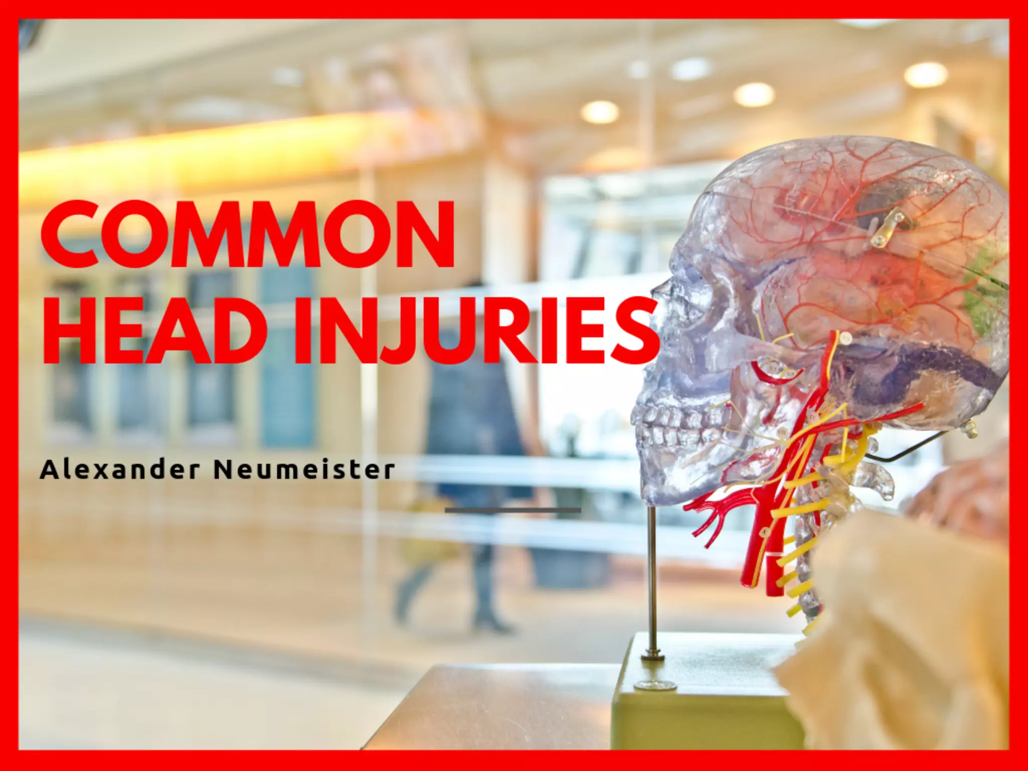 Alexander Neumeister on Common Head Injuries | PDF