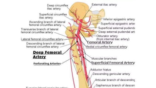 Common Iliac Artery Anatomy.pptx