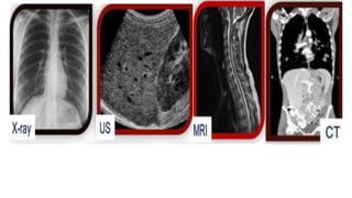 Common Imaging Modalities.pptx uobg somalia | PPTX