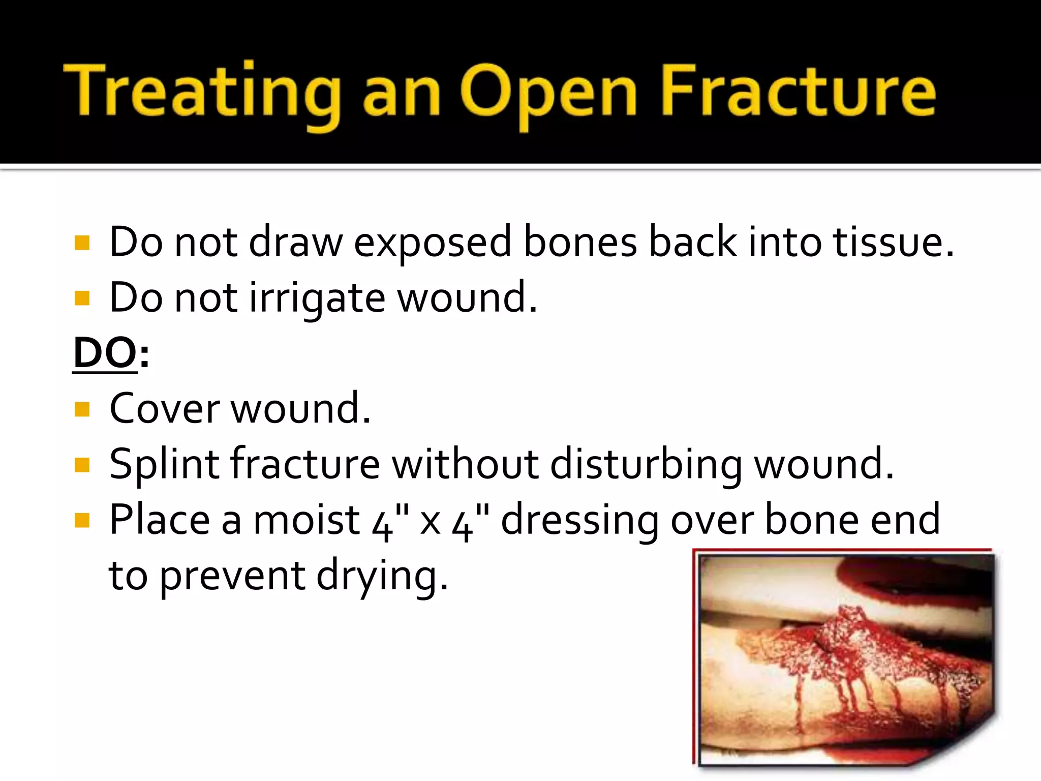 common injuries.ppt