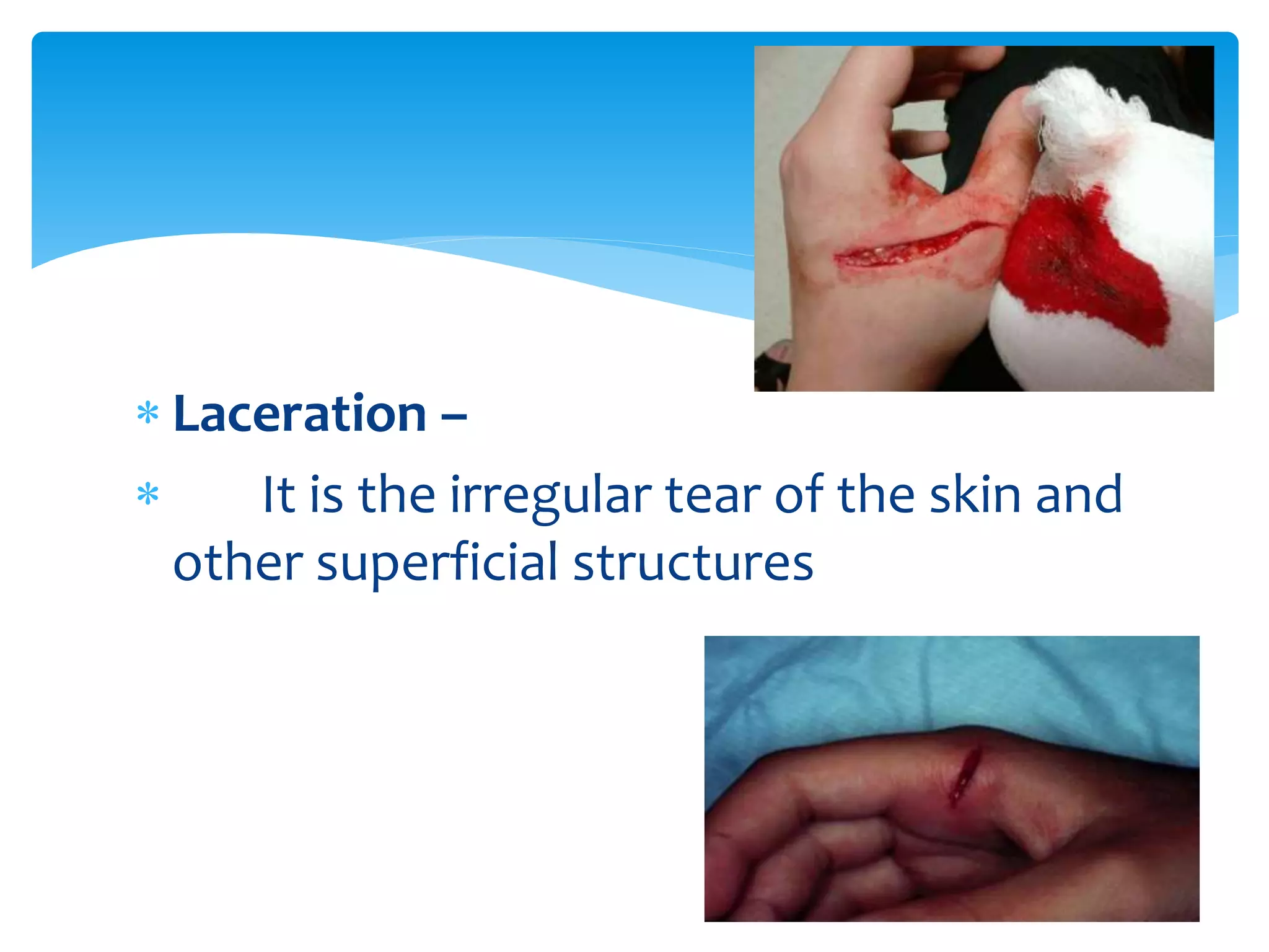 COMMON INJURIES AND FIRST AID.pptx