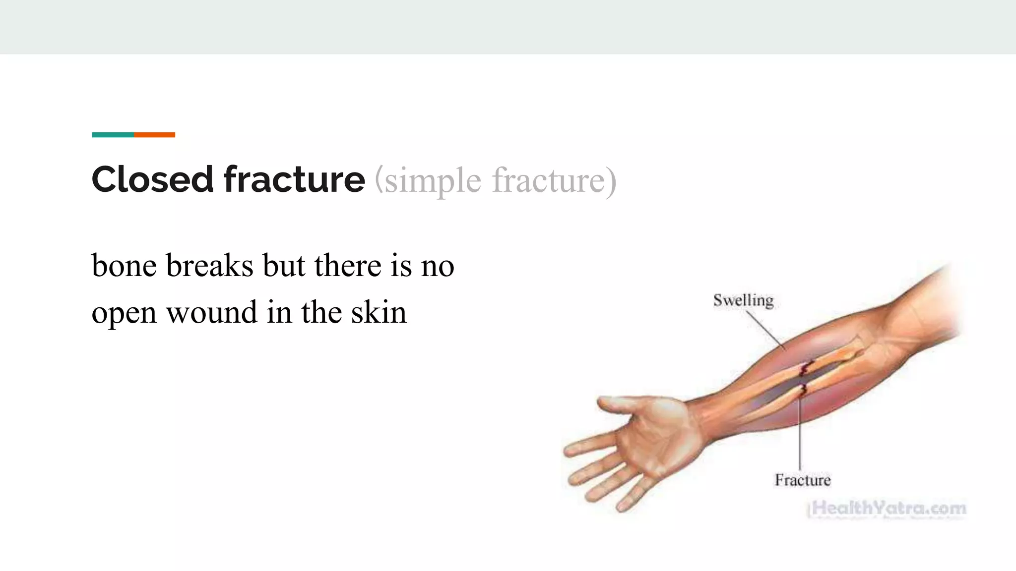 Common Injuries in the Skeletal System | PPTX