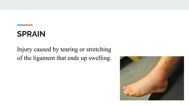 Common Injuries in the Skeletal System | PPTX