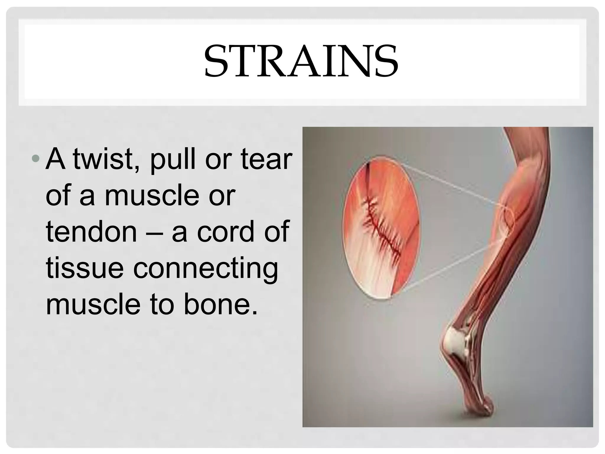 Common injuries involved in active recreation | PPTX