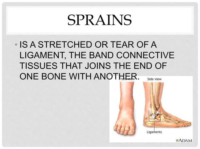Common injuries involved in active recreation | PPTX Common injuries involved in active recreation | PPTX