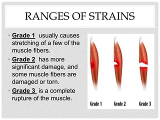 Common injuries involved in active recreation | PPTX