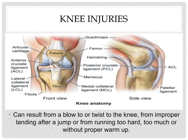Common injuries involved in active recreation | PPTX Common injuries involved in active recreation | PPTX