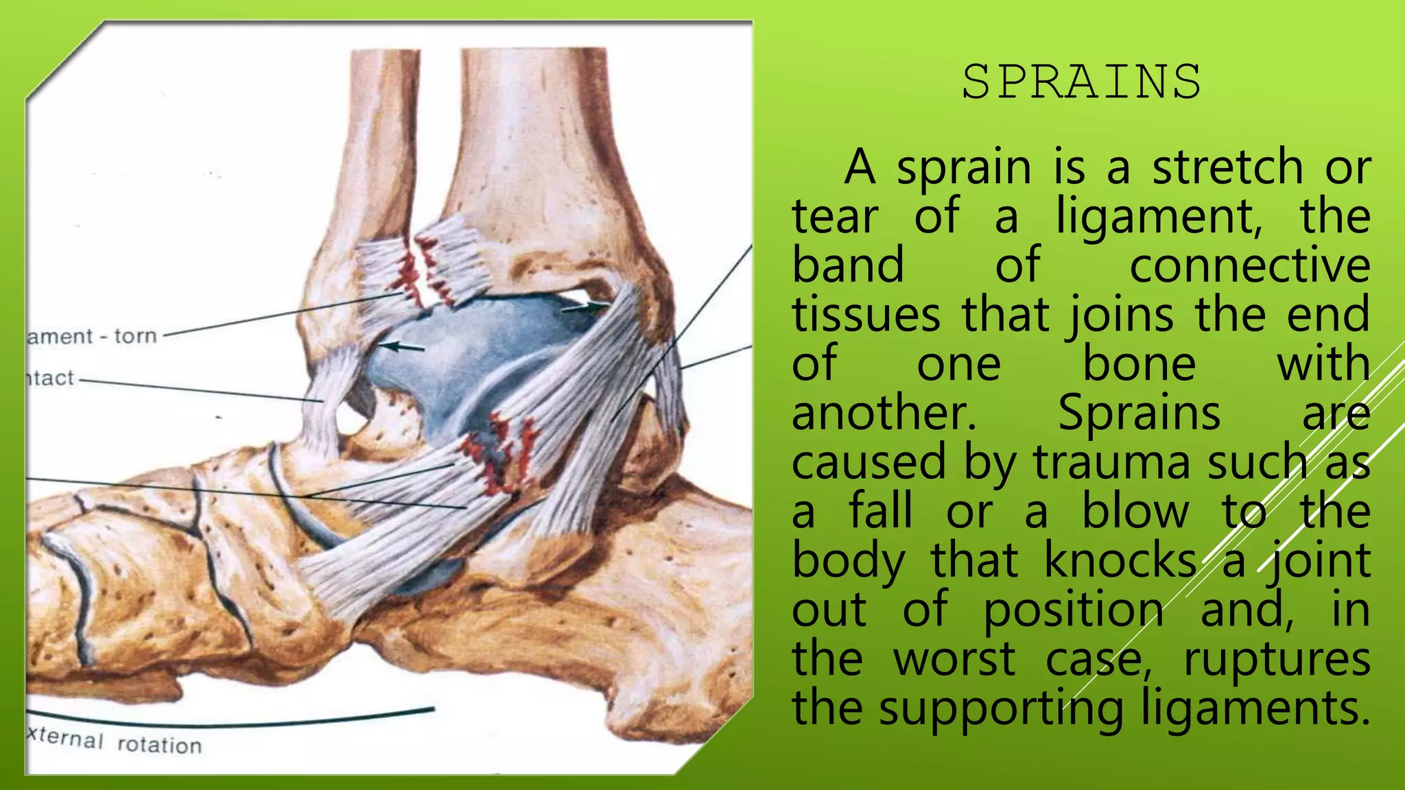 COMMON INJURIES INVOLVED IN ACTIVE RECREATIONAL ACTIVITIES.pptx COMMON INJURIES INVOLVED IN ACTIVE RECREATIONAL ACTIVITIES.pptx