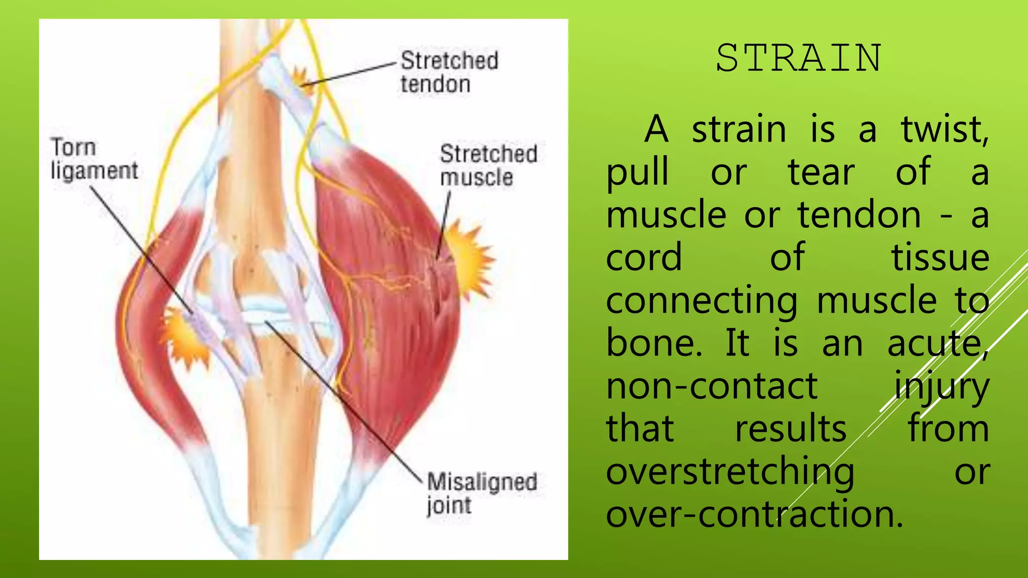 COMMON INJURIES INVOLVED IN ACTIVE RECREATIONAL ACTIVITIES.pptx COMMON INJURIES INVOLVED IN ACTIVE RECREATIONAL ACTIVITIES.pptx