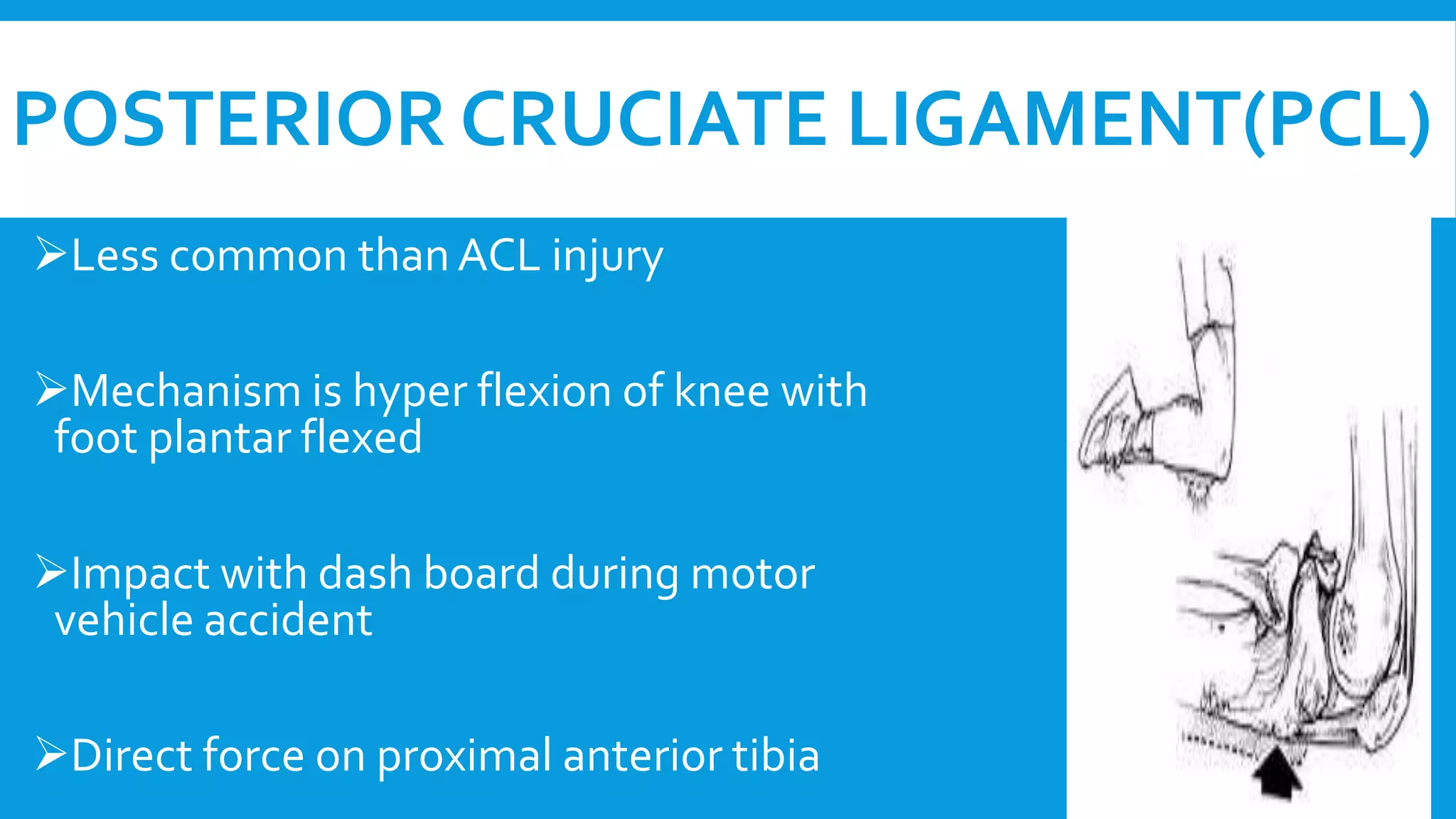Common injuries of lower extremity | PPTX