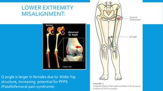 Common injuries of lower extremity | PPTX