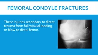 Common injuries of lower extremity | PPTX